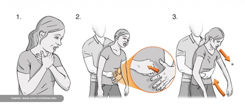 Maniobra de Heimlich, aprende a hacerla – prevento